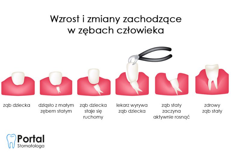 Wiek zębowy - Portal Stomatologa