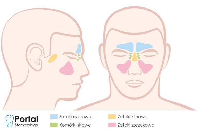 Zatoka klinowa - Portal Stomatologa