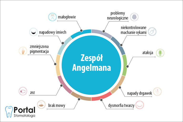 Mięsień rzęskowy - Portal Stomatologa
