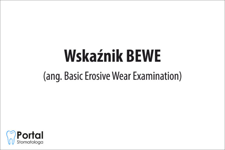 Wskaźnik BEWE - Portal Stomatologa